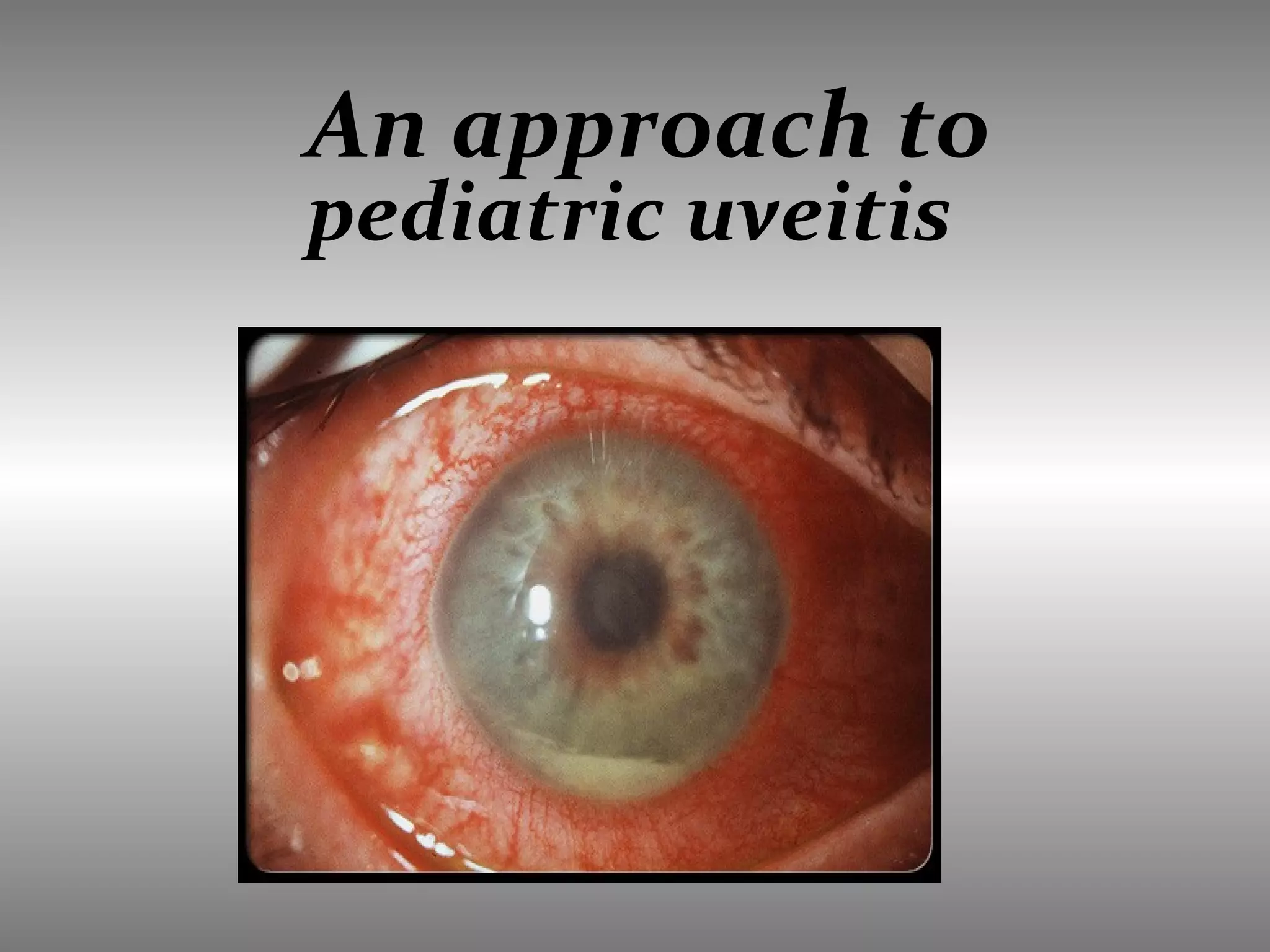 Uveitis in children - by dr. Marwa Mostafa (MS) | PPT