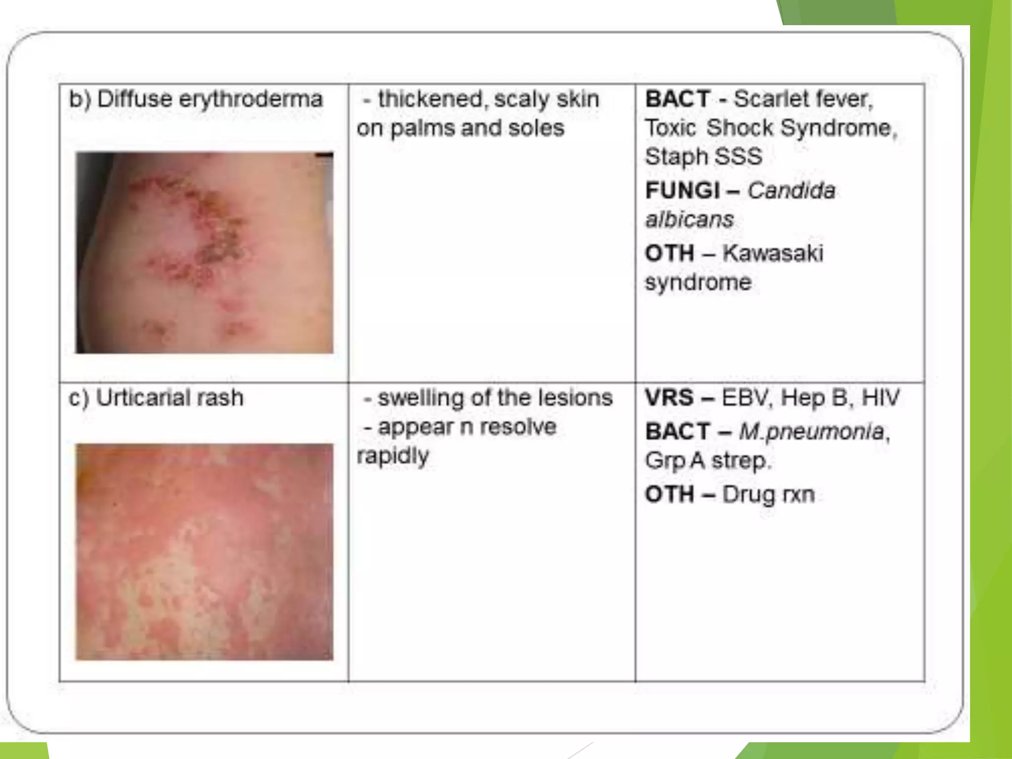 approach to child with fever and Rash | PPTX