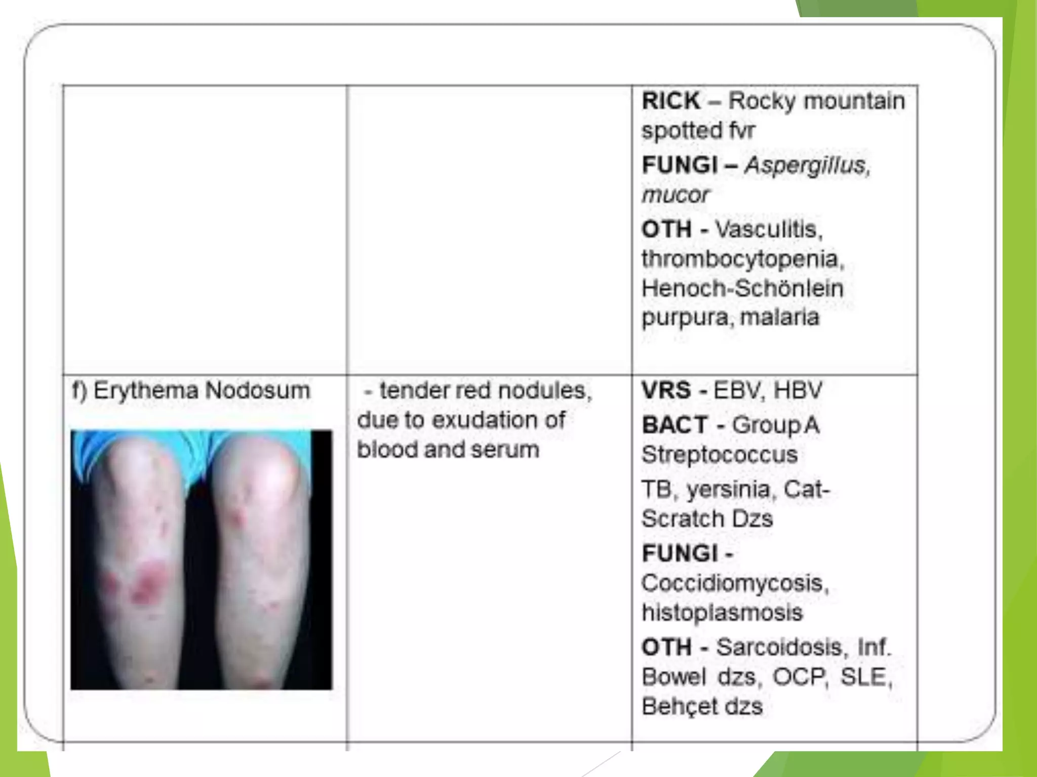approach to child with fever and Rash | PPTX