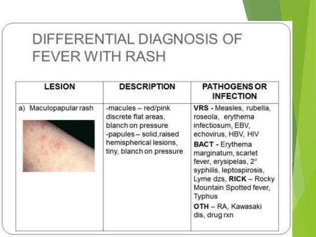approach to child with fever and Rash
