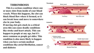 Thrombosis | PPTX