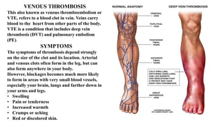 Thrombosis | PPTX