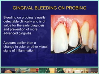 Gingivitis | PPTX