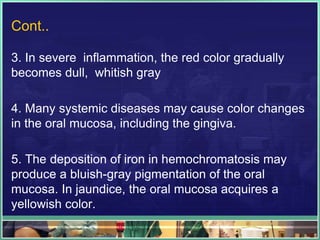 Gingivitis | PPTX