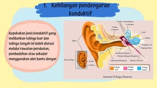 EDUP3103: MASALAH PENDENGARAN.pdf