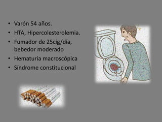 Caso clinico: neoplasia renal | PPTX