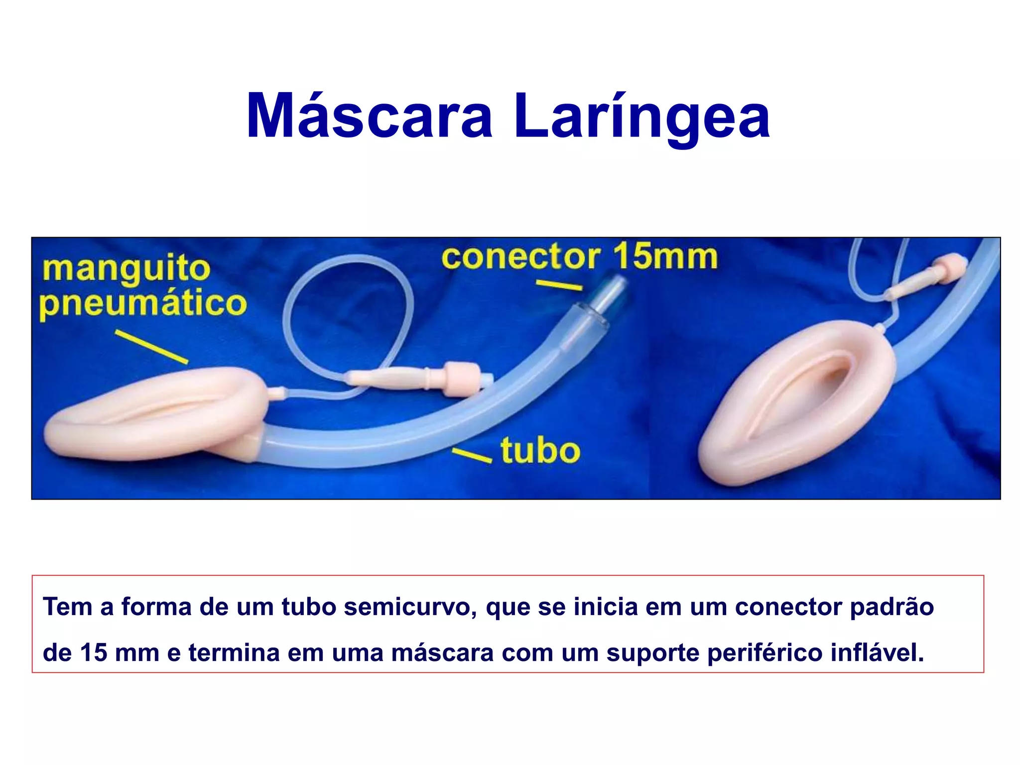 Mascara.laringea | PPT