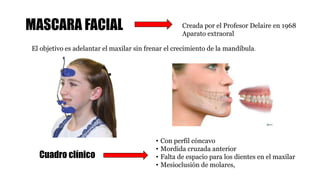 MASCARA FACIAL de rickets y macnamara.pptx