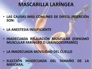 Mascarilla laríngea | PPTX