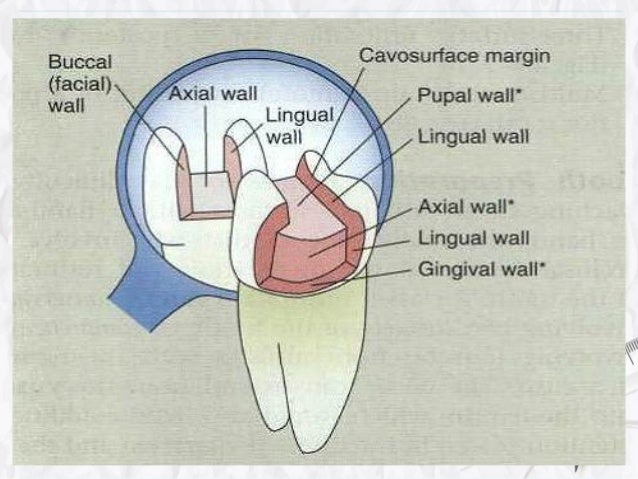 tooth preparation and maintaining pulp vitality