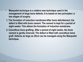 Masquelet technique for management of large bone defects. | PPTX | First Aid | Injuries