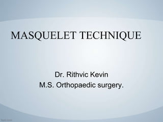 Masquelet technique for management of large bone defects. | PPTX