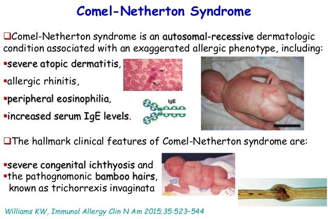 Format 2016: masqueradesyndromes in allergicdiseases.