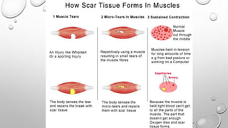 Scar tissue & Massage | PPTX