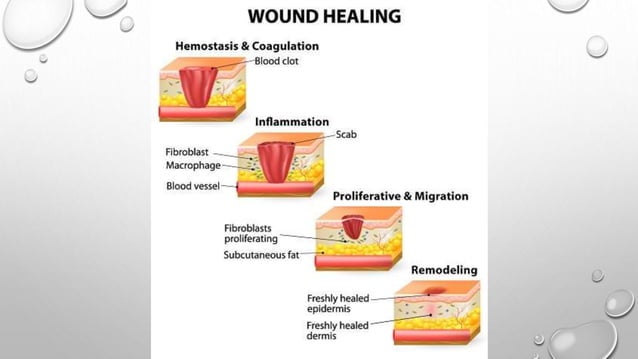 Scar tissue & Massage | PPTX | First Aid | Injuries