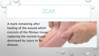 Scar tissue & Massage | PPTX