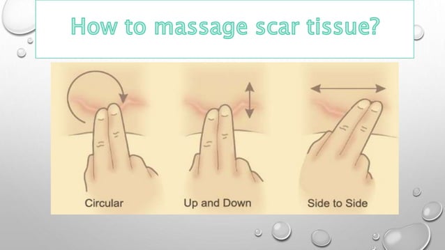 Scar tissue & Massage | PPTX | First Aid | Injuries