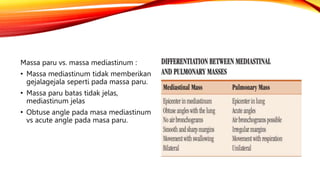 Massa Mediastinum.pptx