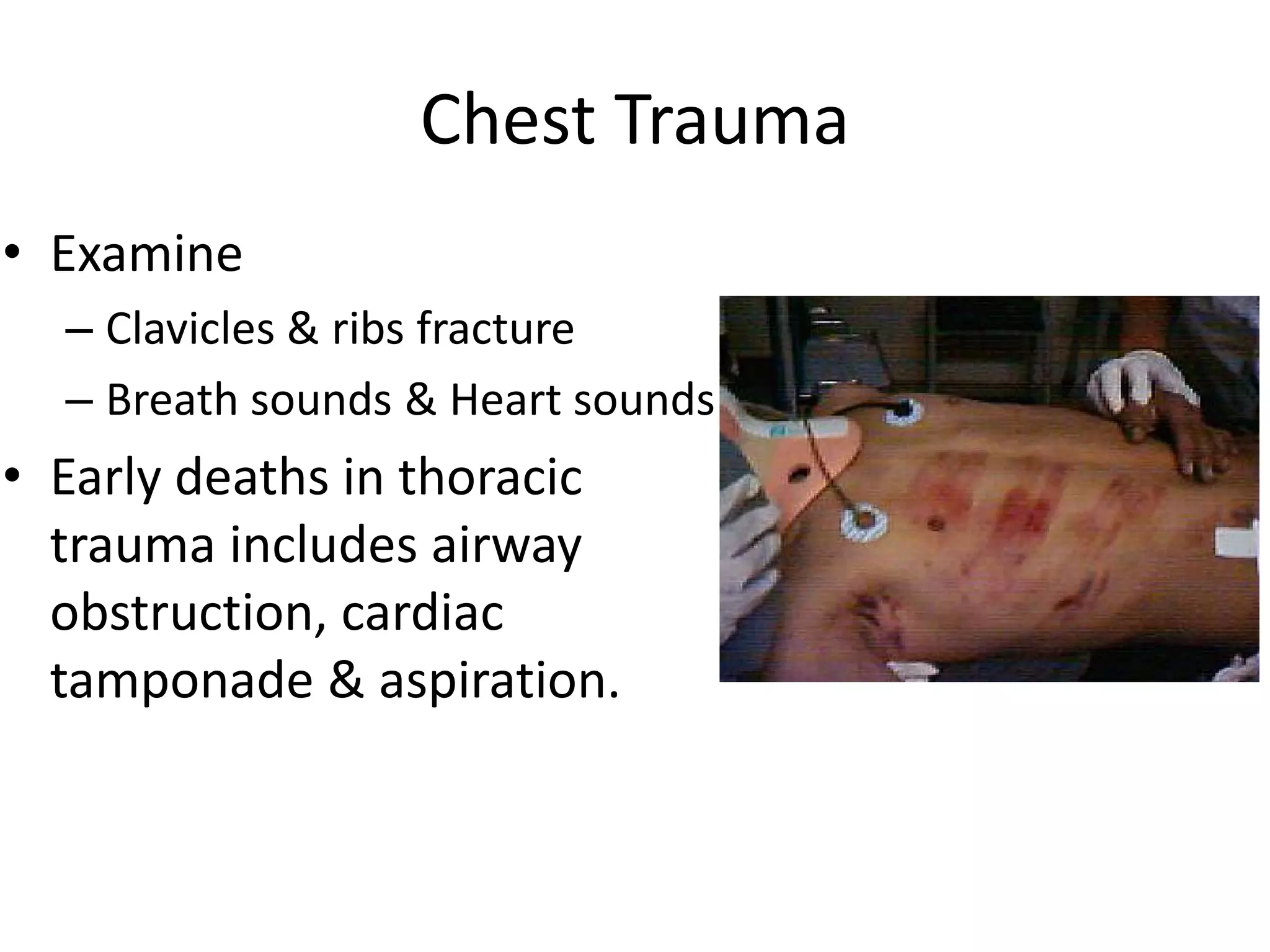 Mass casualty management | PPSX