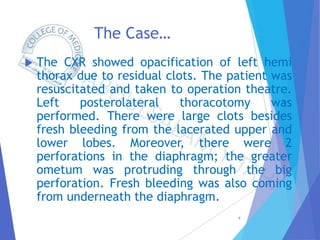Massive Haemothorax and Acute Abdomen due to Bullet Injury.pdf