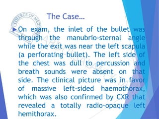 Massive Haemothorax due to Bullet Injury.pdf