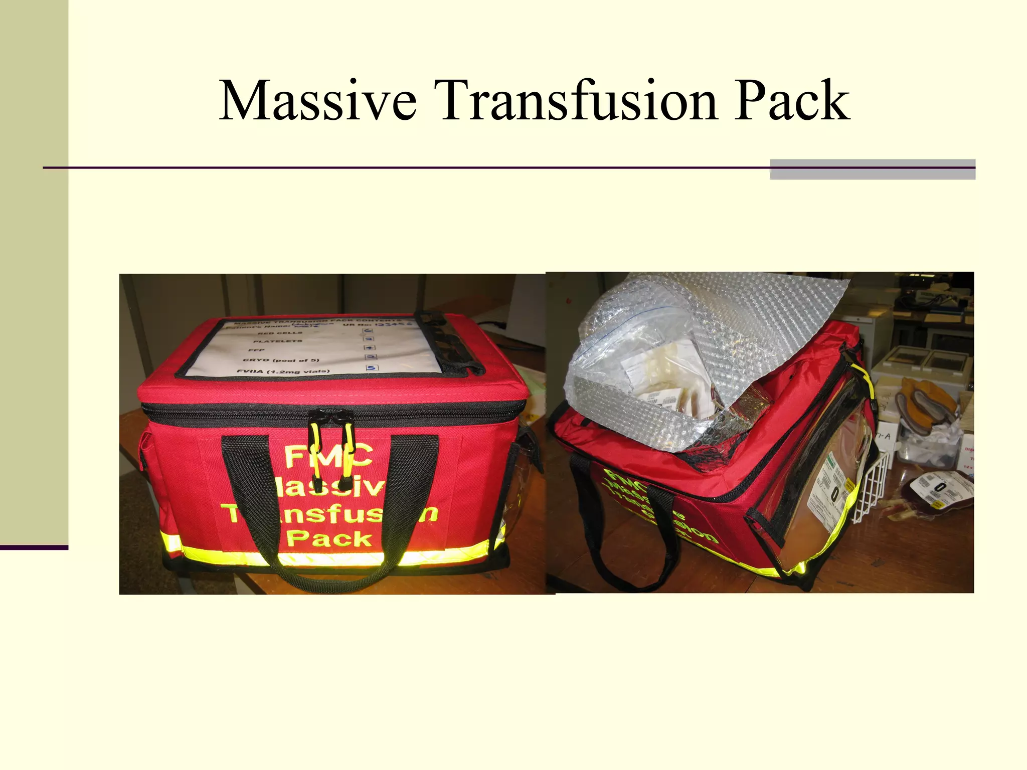 Massive Transfusion In Trauma | PPT