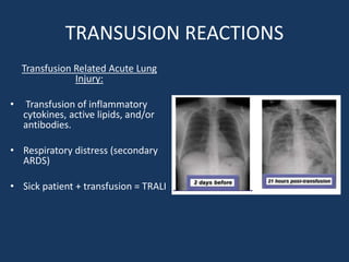 Massive Transfusion Protocol + Blood transfusions | PPTX