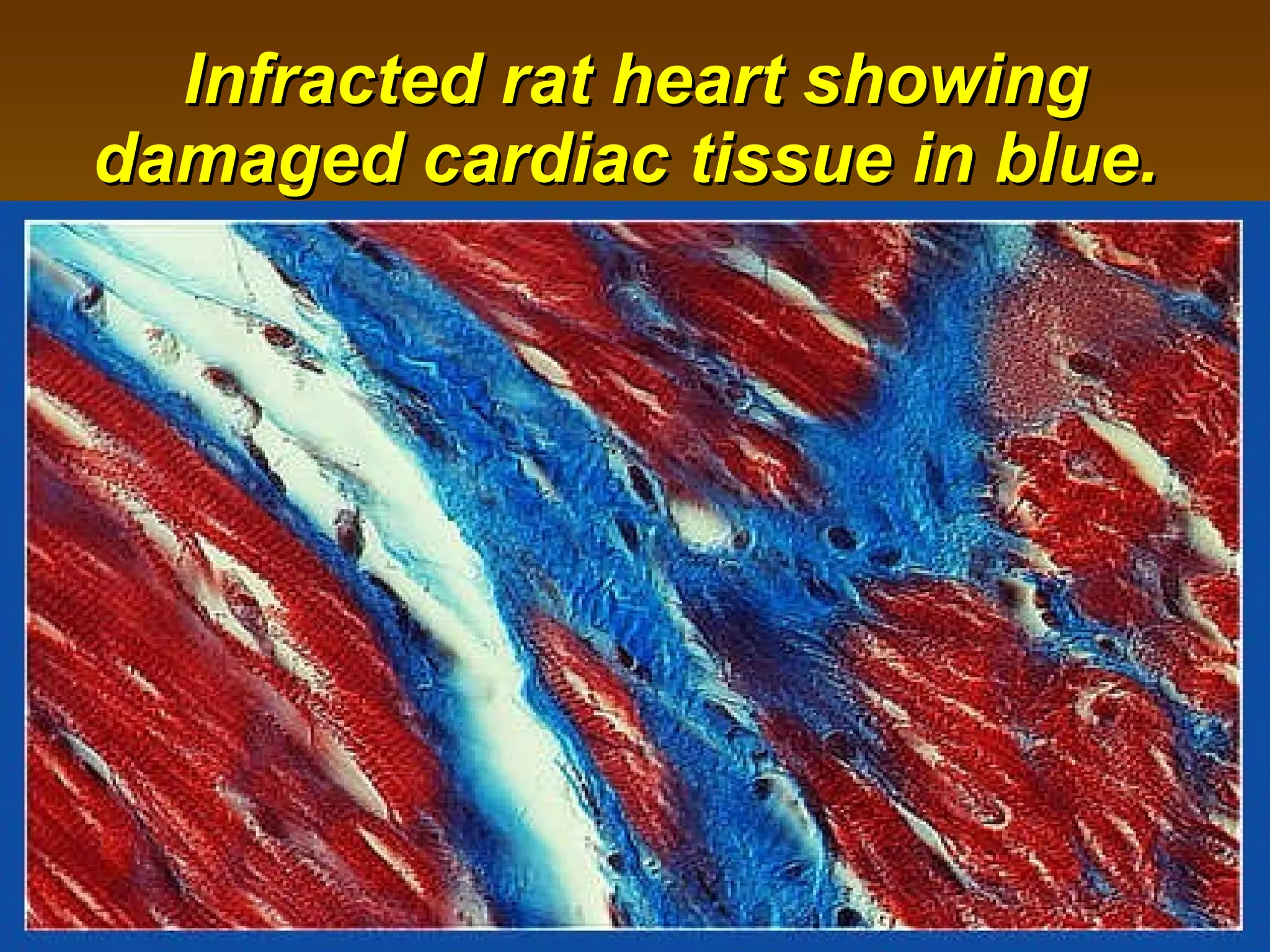 Massons Trichrome Stain | PPT