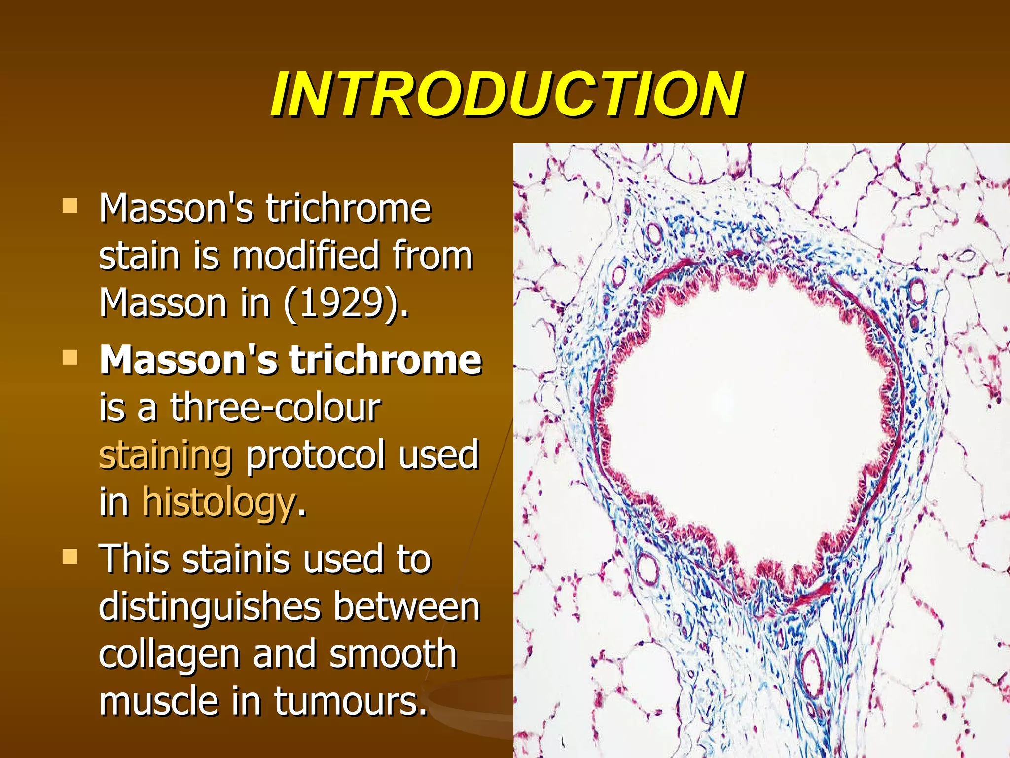Massons Trichrome Stain | PPT