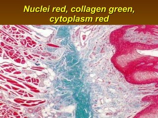 Massons Trichrome Stain | PPT