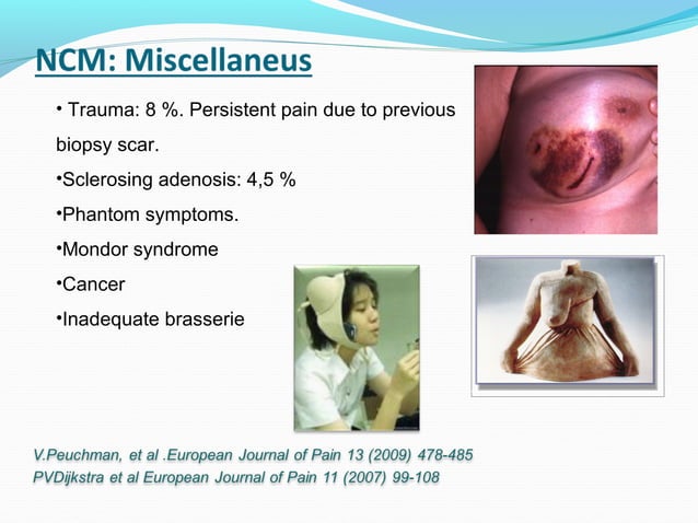 Mastalgia, breast pain. Dra Moreno (www.oncocir.com) | PPT