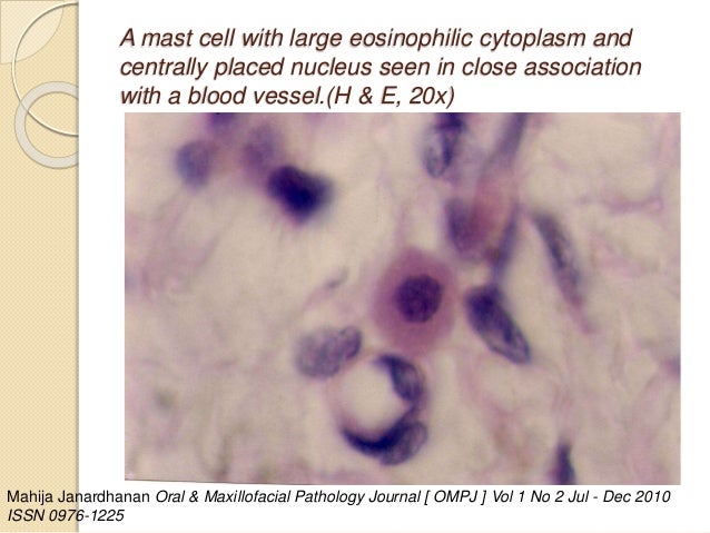 Mast cell - Oral Pathology