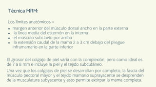 Mastectomia | PPTX