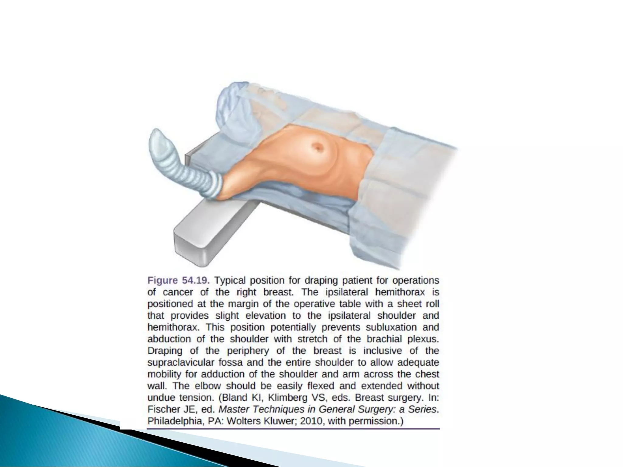 Mastectomy | PDF