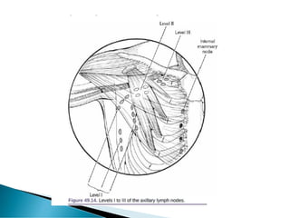 Mastectomy | PDF