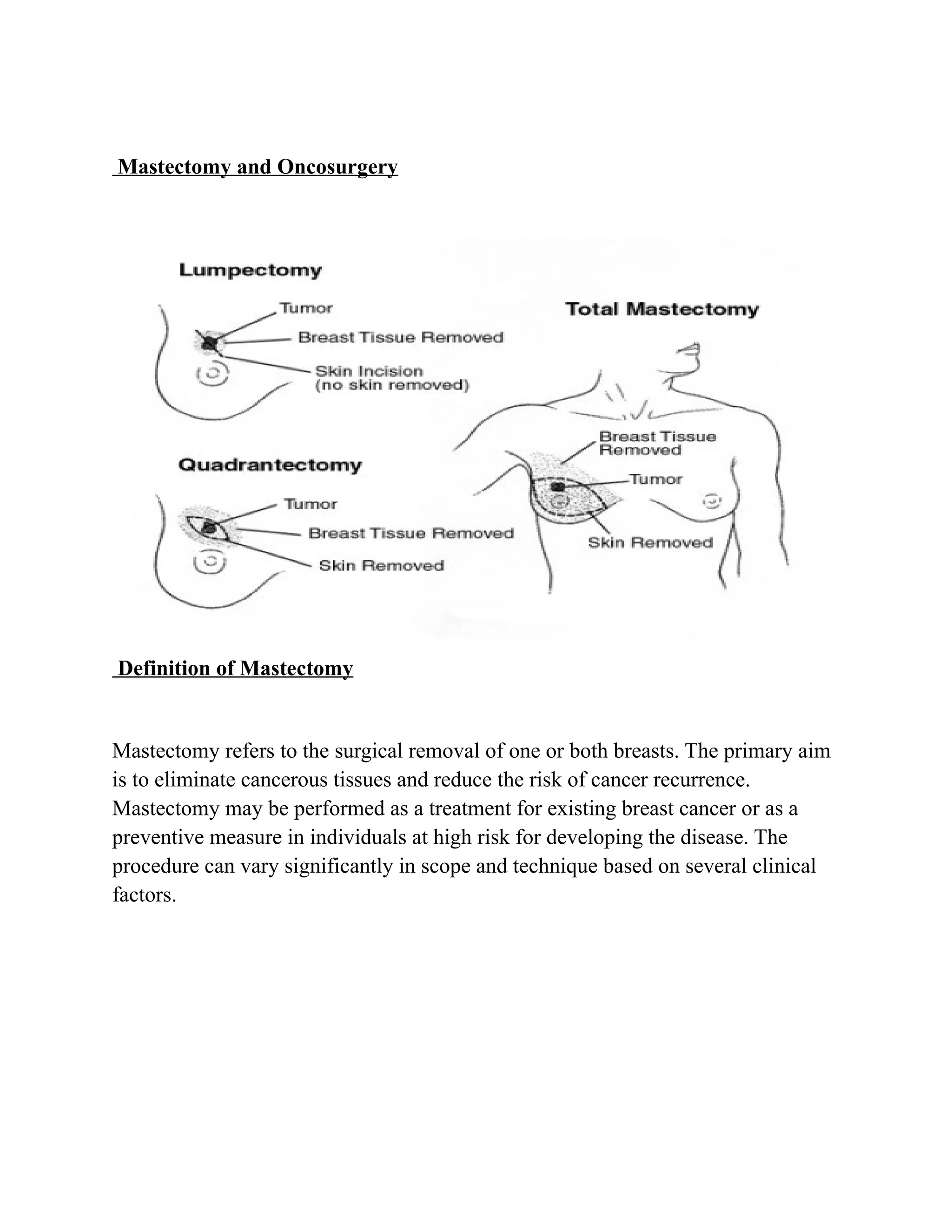 mastectomy and oncosurgery- definition, types ..... | DOCX