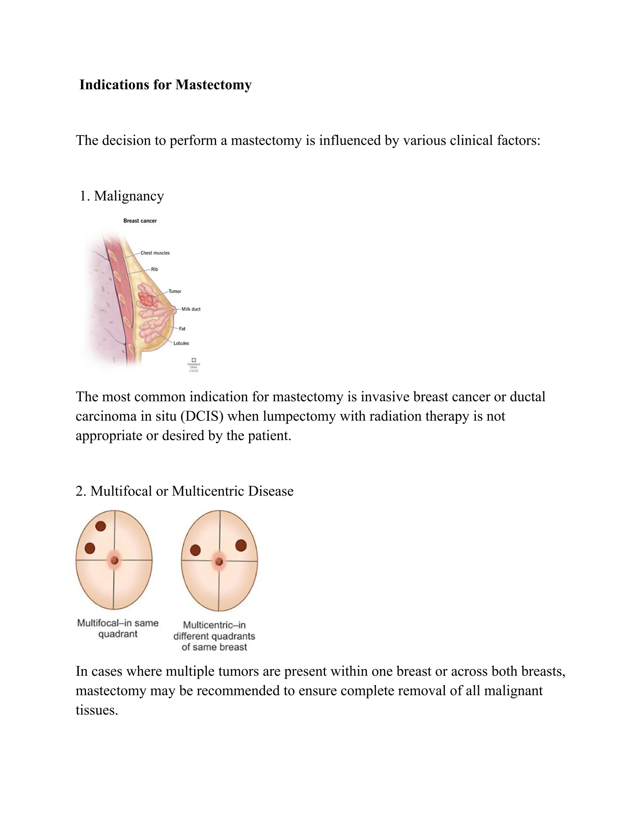 mastectomy and oncosurgery- definition, types ..... | DOCX