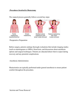 mastectomy and oncosurgery- definition, types ..... | DOCX