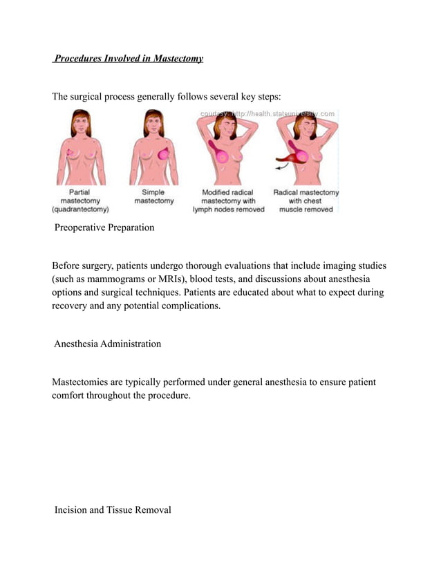 mastectomy and oncosurgery- definition, types ..... | DOCX
