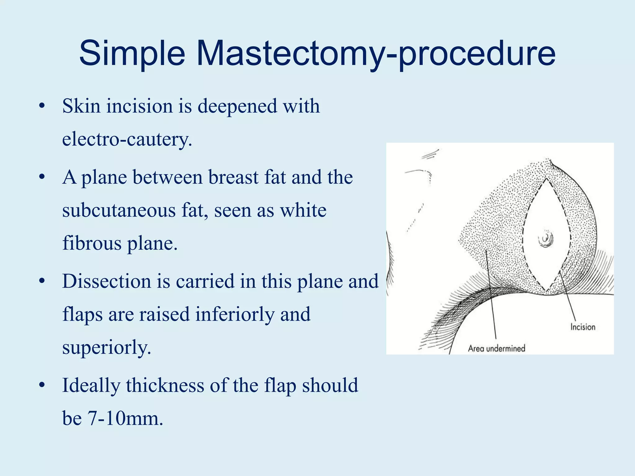 Mastectomy | PPTX