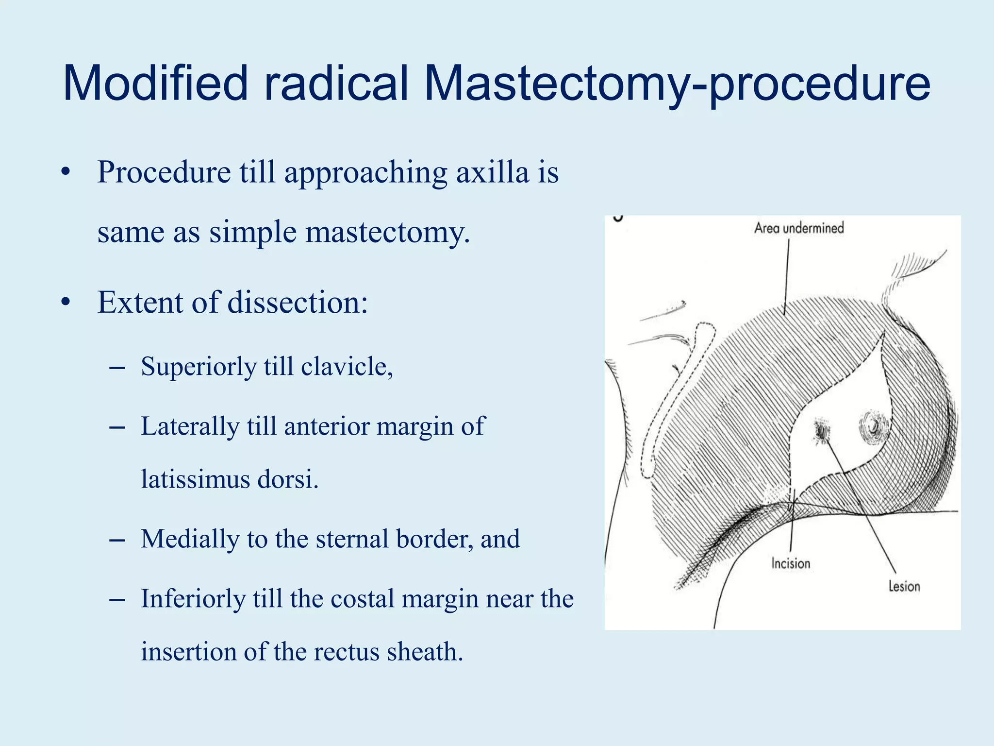 Mastectomy | PPTX