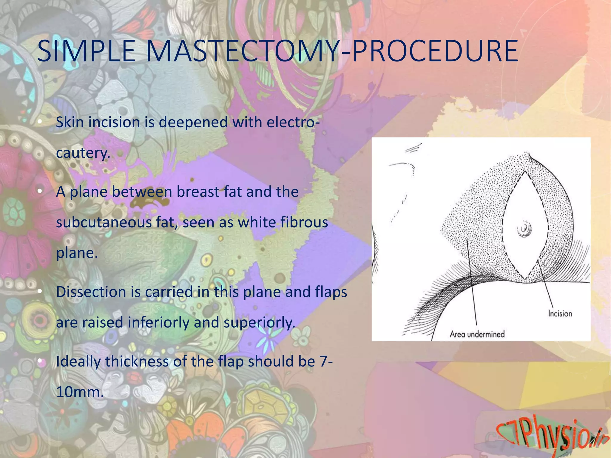 Mastectomy | PPTX
