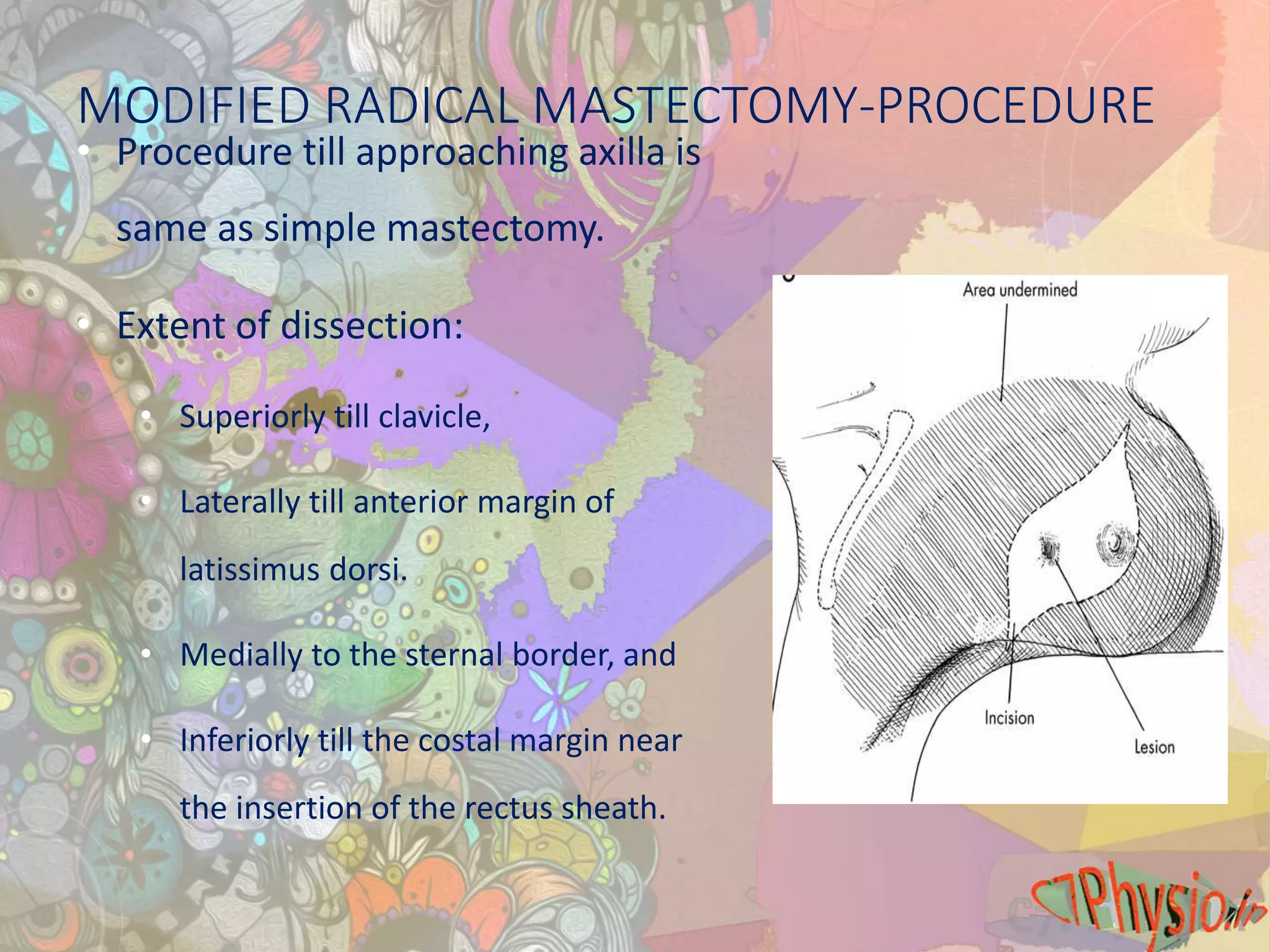 Mastectomy | PPTX