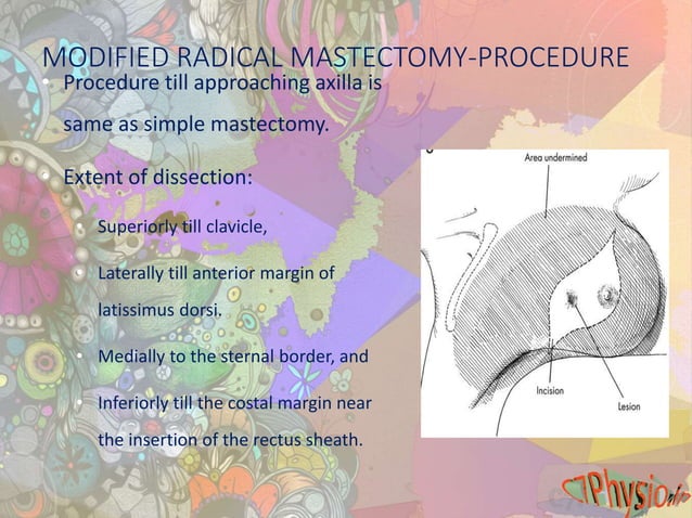 Mastectomy | PPTX