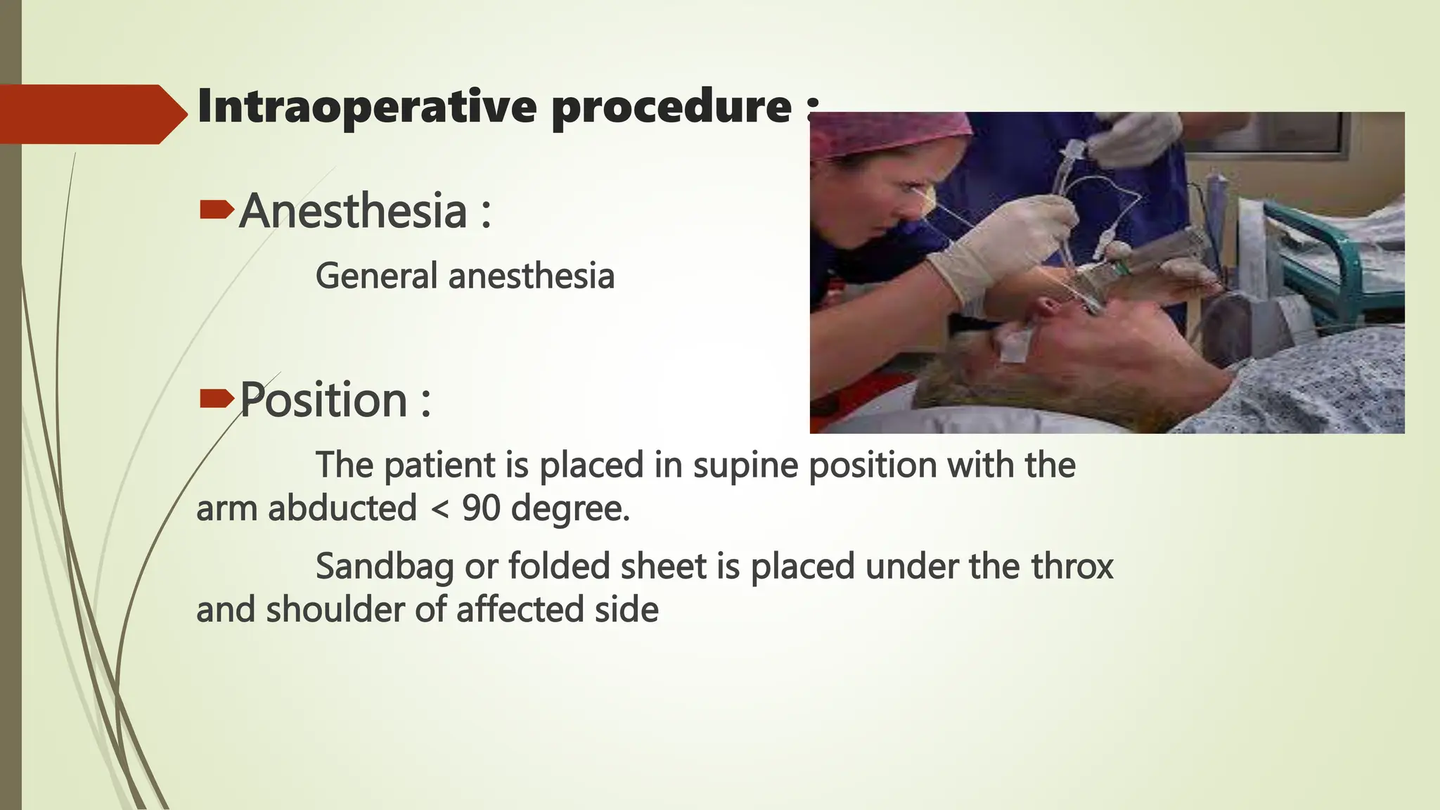 Modified radical mastectomy presentation | PPTX