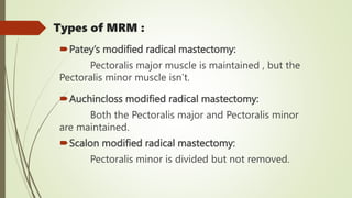 Modified radical mastectomy presentation | PPTX