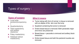 Mastectomy | PPTX