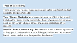 Mastectomy_ Types, Indications, and What to Expect Post-Surgery.pdf