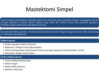 Mastektomi iv | PPTX