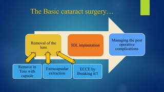 REview of Phacoemulsification | PPT
